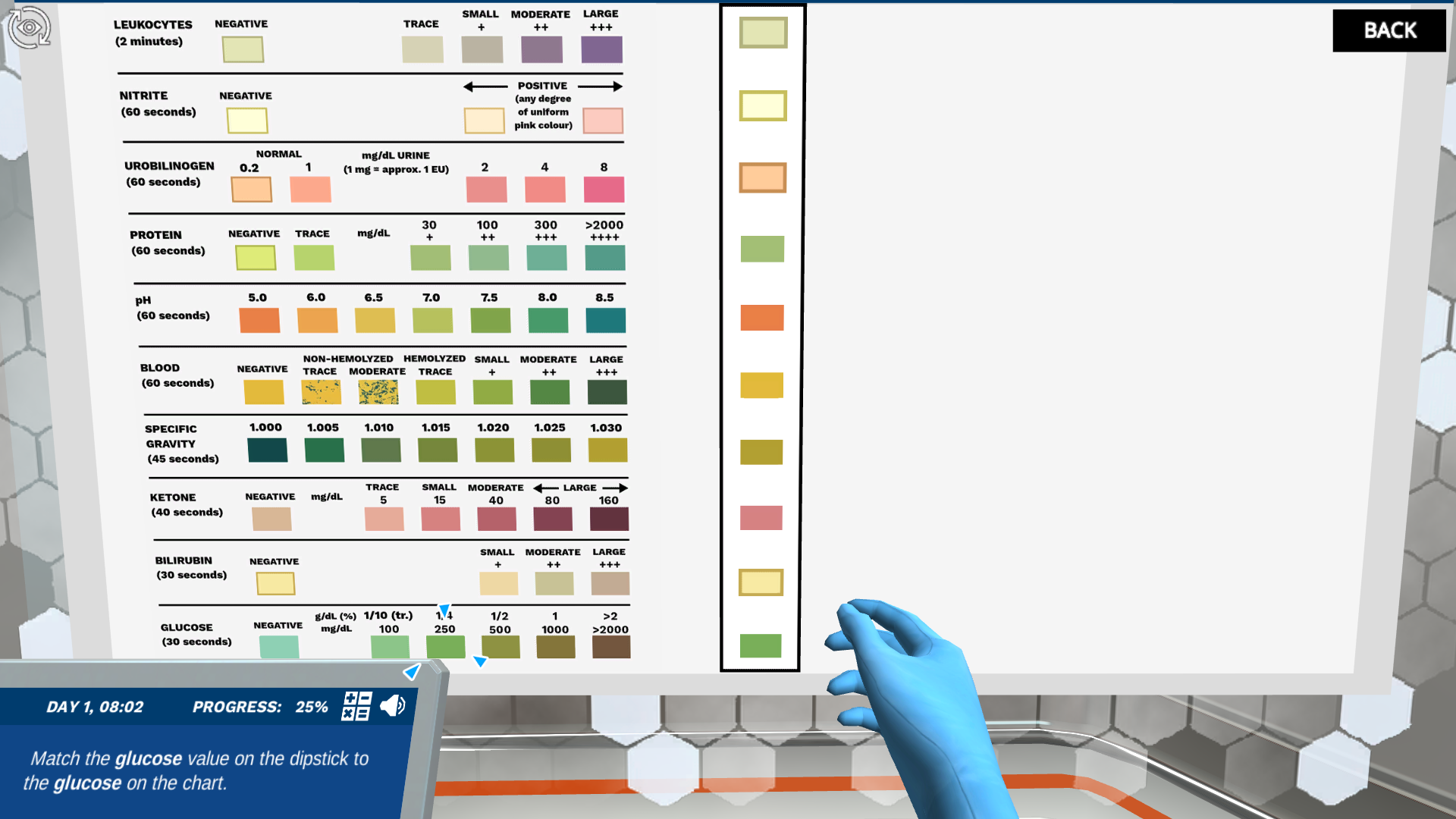 Urinalysis: Analyze urine to suggest a diagnosis | Labster Virtual Labs